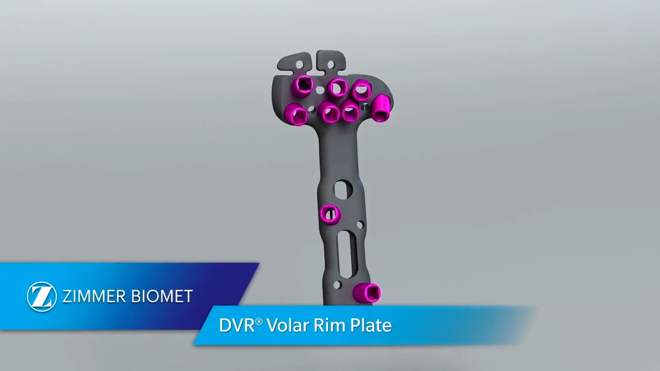 DVR® Volar Rim Plate