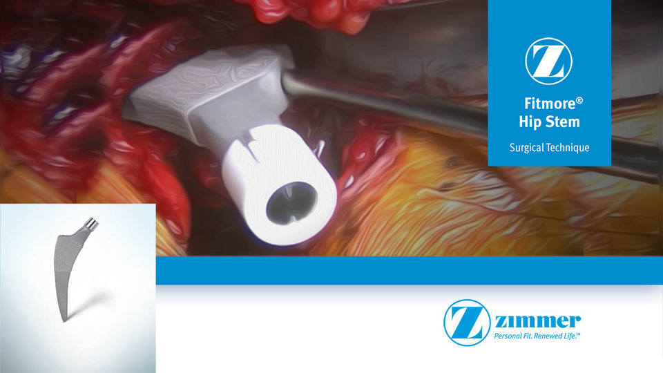 Fitmore® Hip Stem Surgical Technique