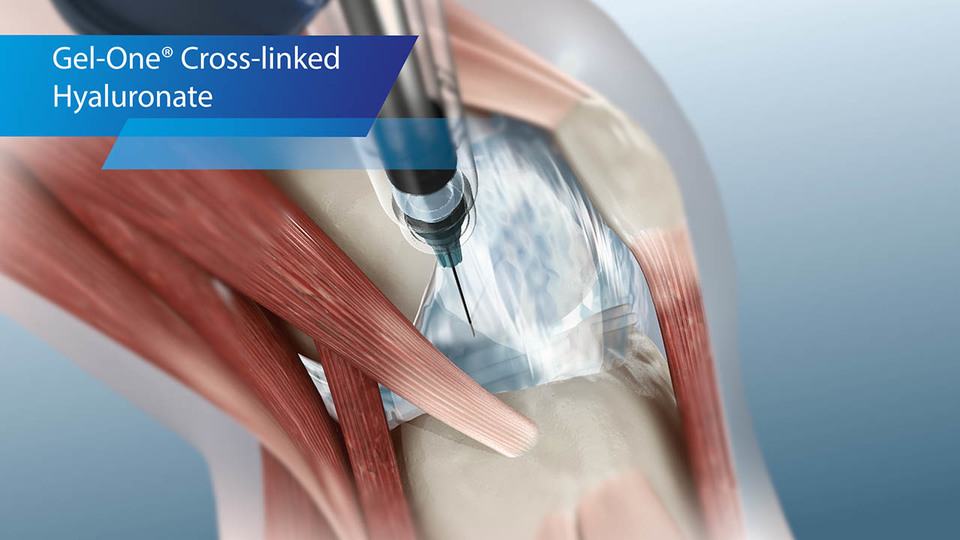 Gel-One® Cross-linked Hyaluronate