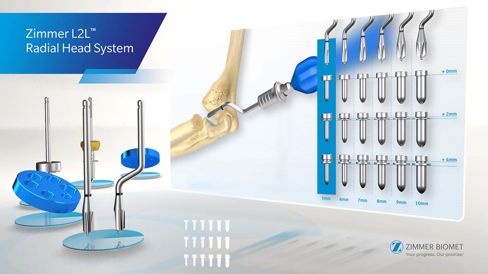 Zimmer L2L™ Radial Head System Surgical Animation