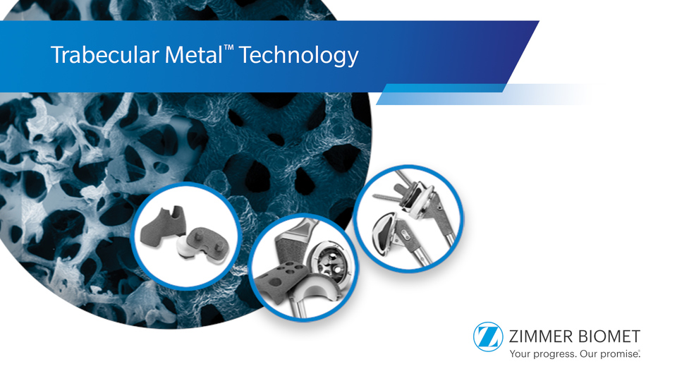Trabecular Metal™ Technology Ingrowth