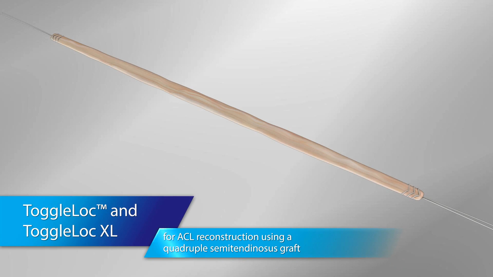 ToggleLoc™ and ToggleLoc XL for ACL reconstruction using a quadruple ...