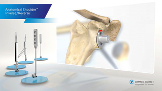 Comprehensive Reverse Shoulder System