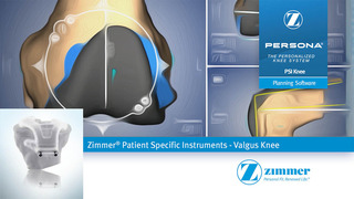 PERSONA® The Personalized Knee System - Featuring the Zimmer® PSI Knee