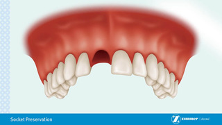 Zimmer Biomet Dental
