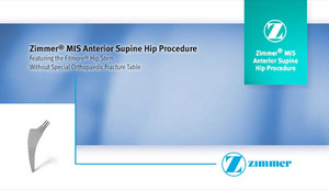 CLS® Spotorno® Hip Stem