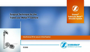 Zimmer® Trabecular Metal™ Shoulder System