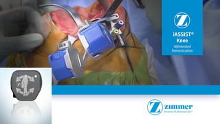 PERSONA® The Personalized Knee System - Featuring the Zimmer® PSI Knee